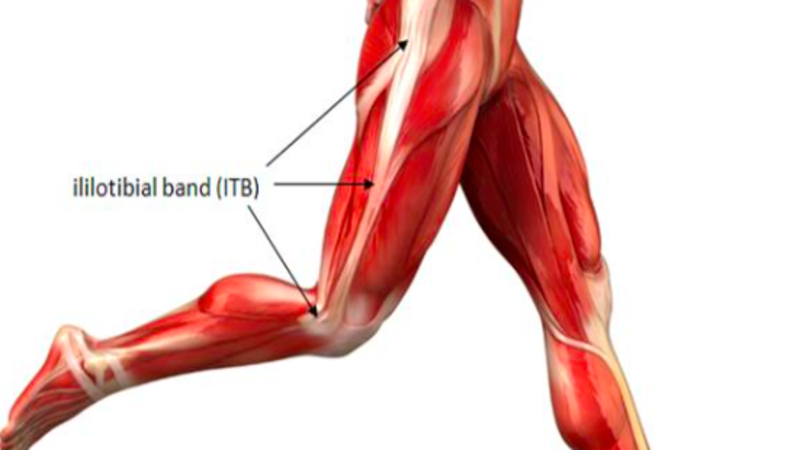What is iliotibial band syndrome and what are its symptoms | Dr Bijan 4 ...